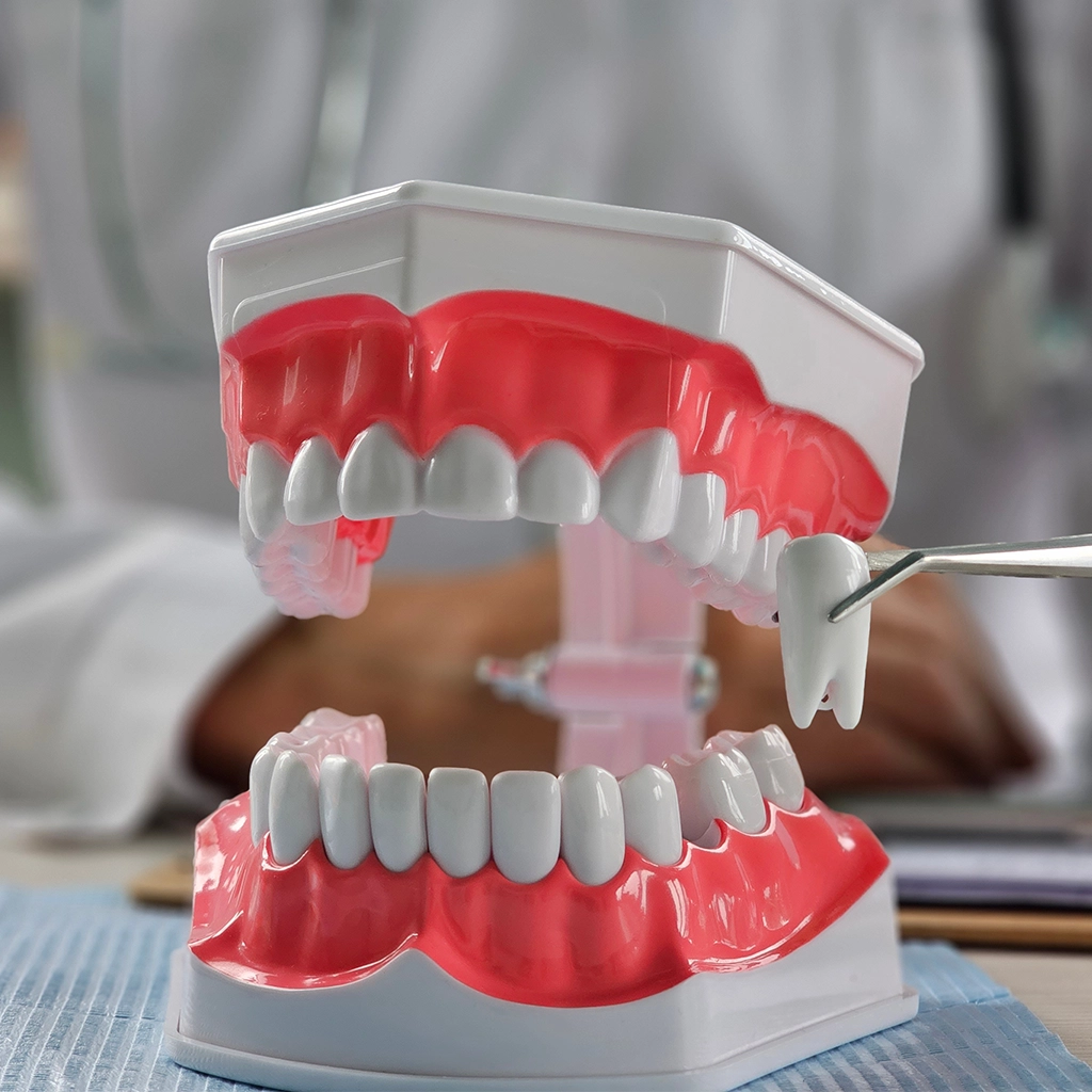 Wisdom Teeth Extraction | Houston Crossroads Dental Care